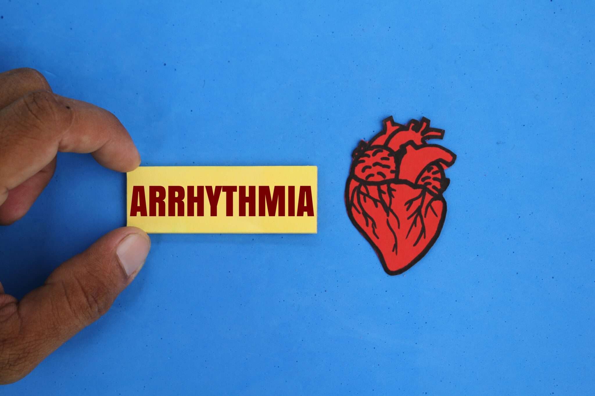 Mengenal Lebih Dekat tentang Aritmia Jantung: Penyebab, Gejala, dan ...