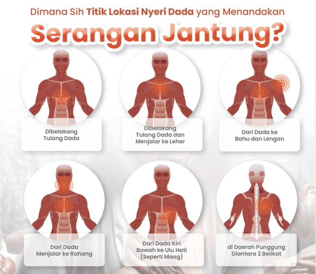 Kenali Lokasi Nyeri Dada yang Bisa Menandakan Serangan Jantung