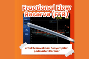 FFR (Fractional Flow Reserve): Teknologi Canggih untuk Deteksi ...