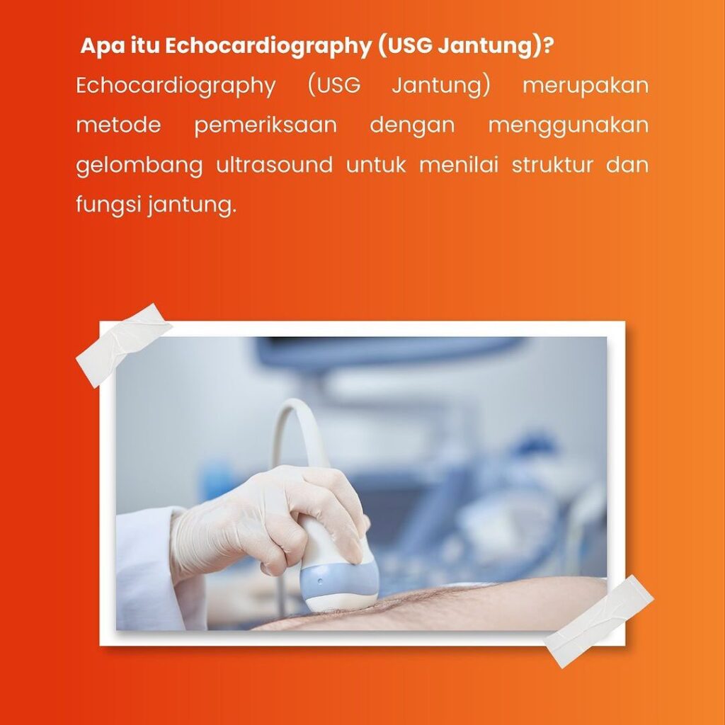 Pentingnya Melakukan USG Jantung atau Echocardiography